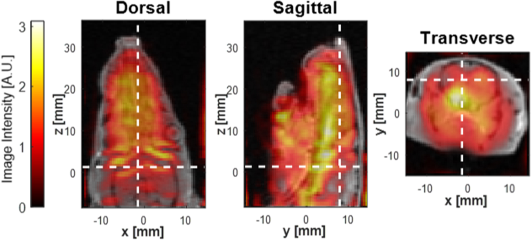 Functional magnetic particle imaging (fMPI) of cerebrovascular changes ...