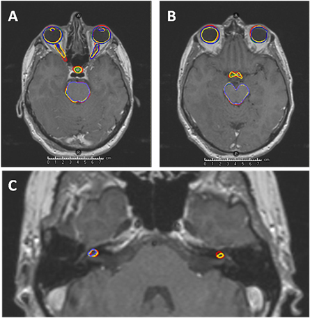 Geometric evaluations of CT and MRI based deep learning segmentation ...