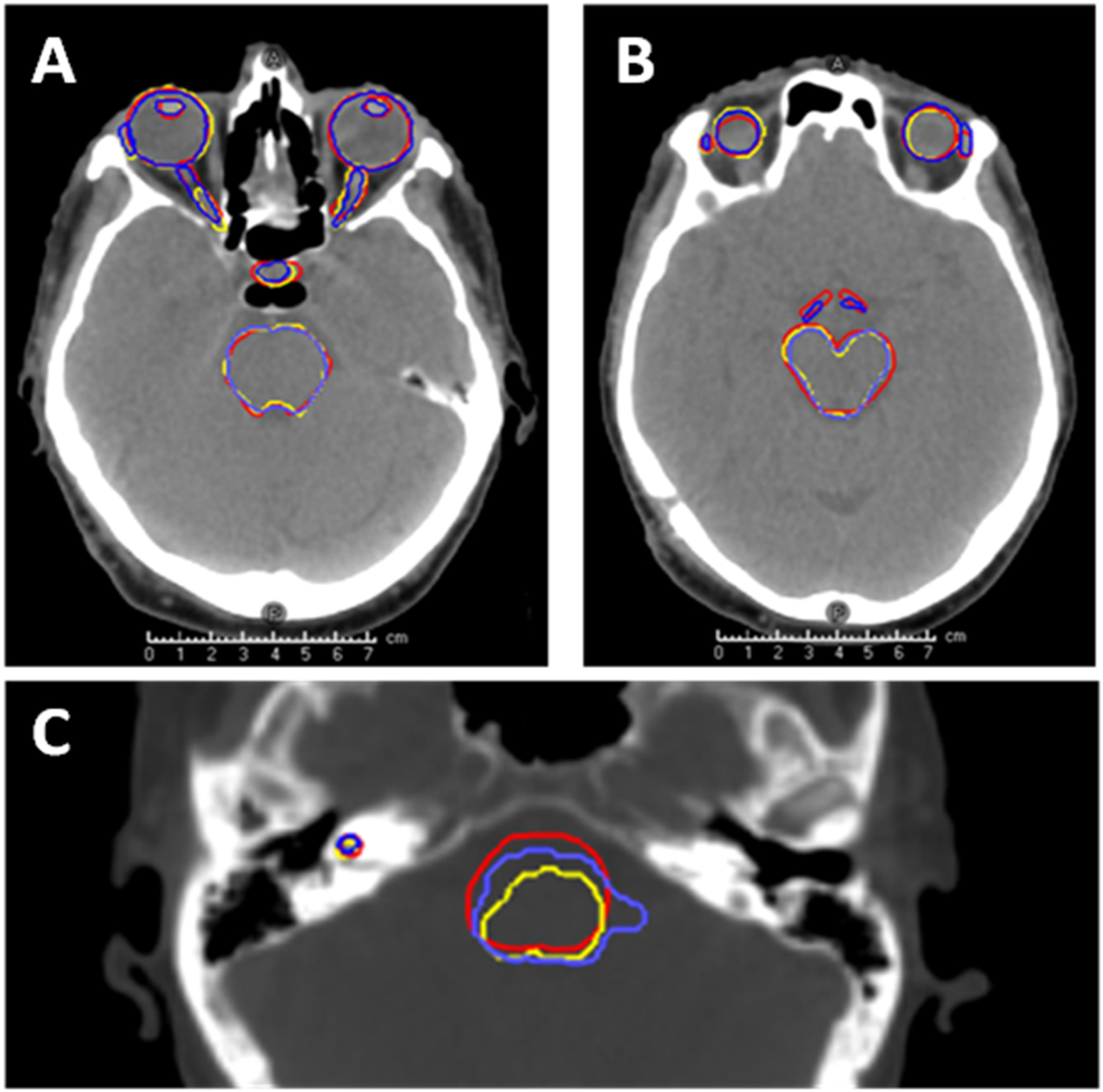Geometric evaluations of CT and MRI based deep learning segmentation ...