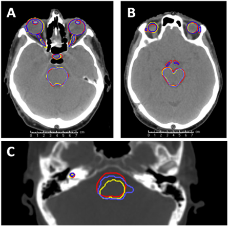 Geometric evaluations of CT and MRI based deep learning segmentation ...