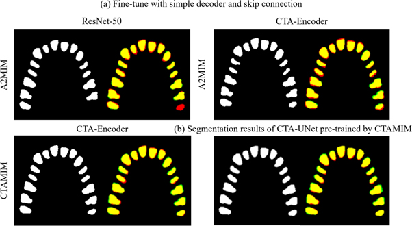 CTA-UNet: CNN-transformer architecture UNet for dental CBCT images ...