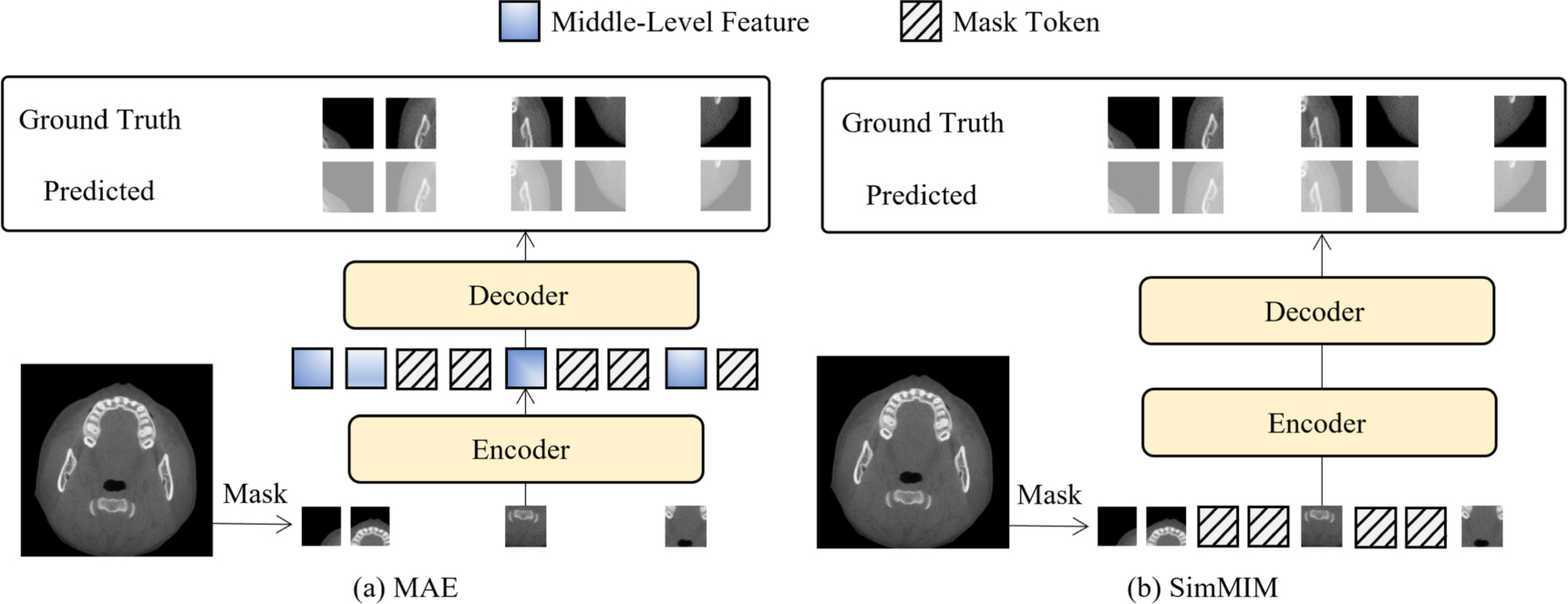 CTA-UNet: CNN-transformer architecture UNet for dental CBCT images ...