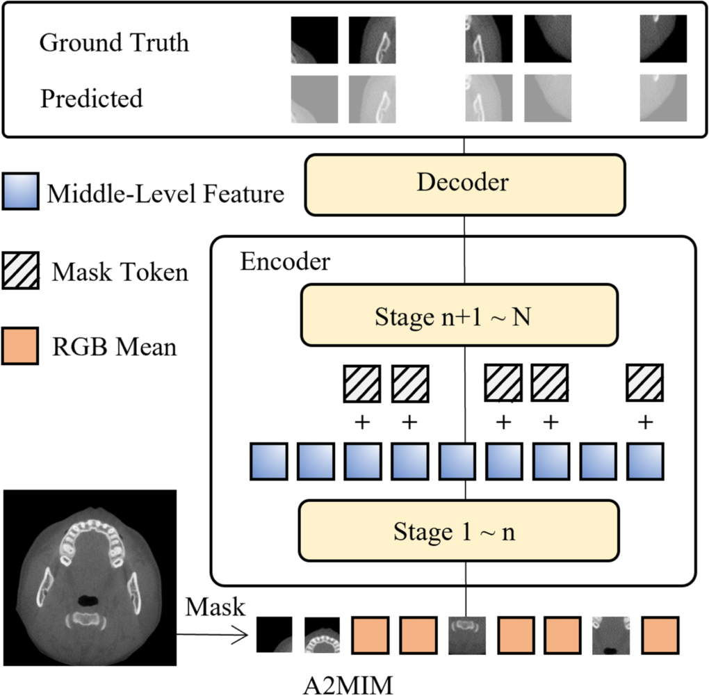 CTA-UNet: CNN-transformer architecture UNet for dental CBCT images ...
