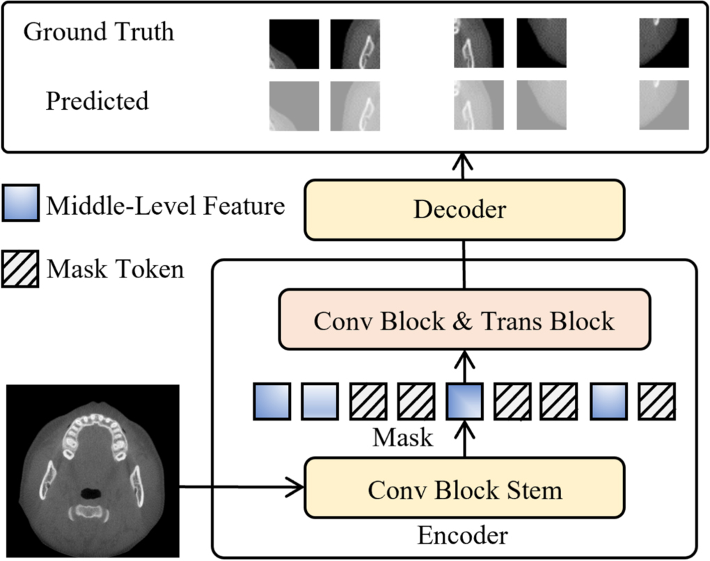 CTA-UNet: CNN-transformer architecture UNet for dental CBCT images ...