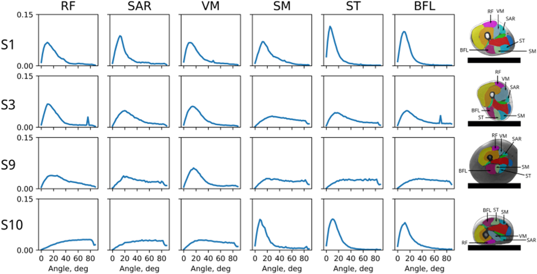 Consistency of muscle fibers directionality in human thigh derived from ...