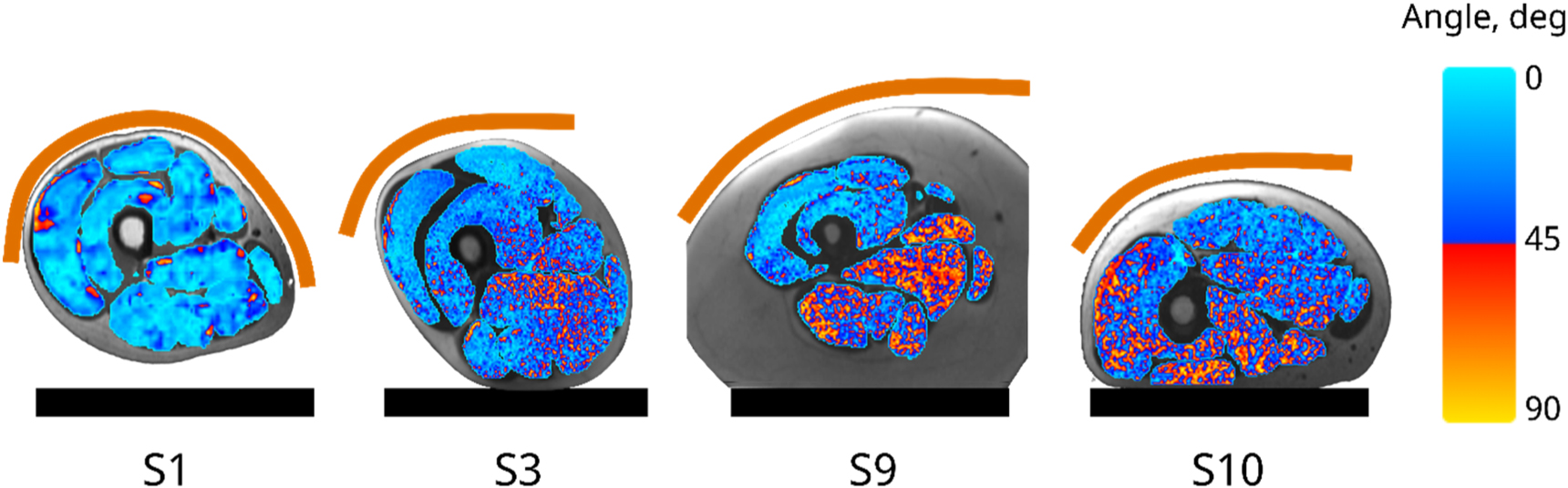 Consistency of muscle fibers directionality in human thigh derived from ...
