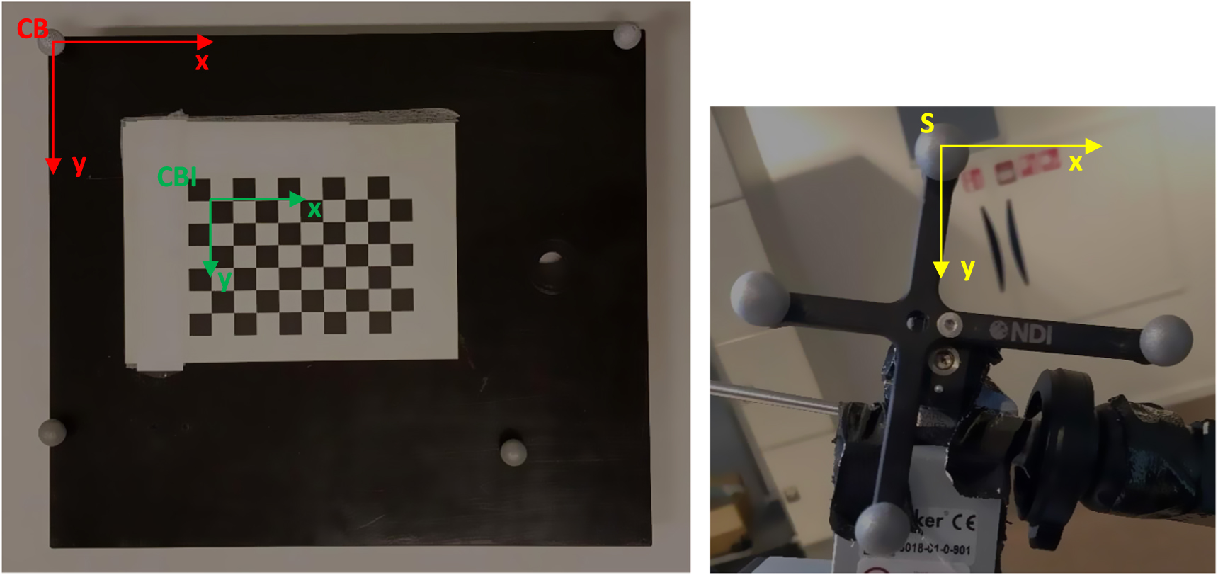 An improved camera model for oblique-viewing laparoscopes: high ...