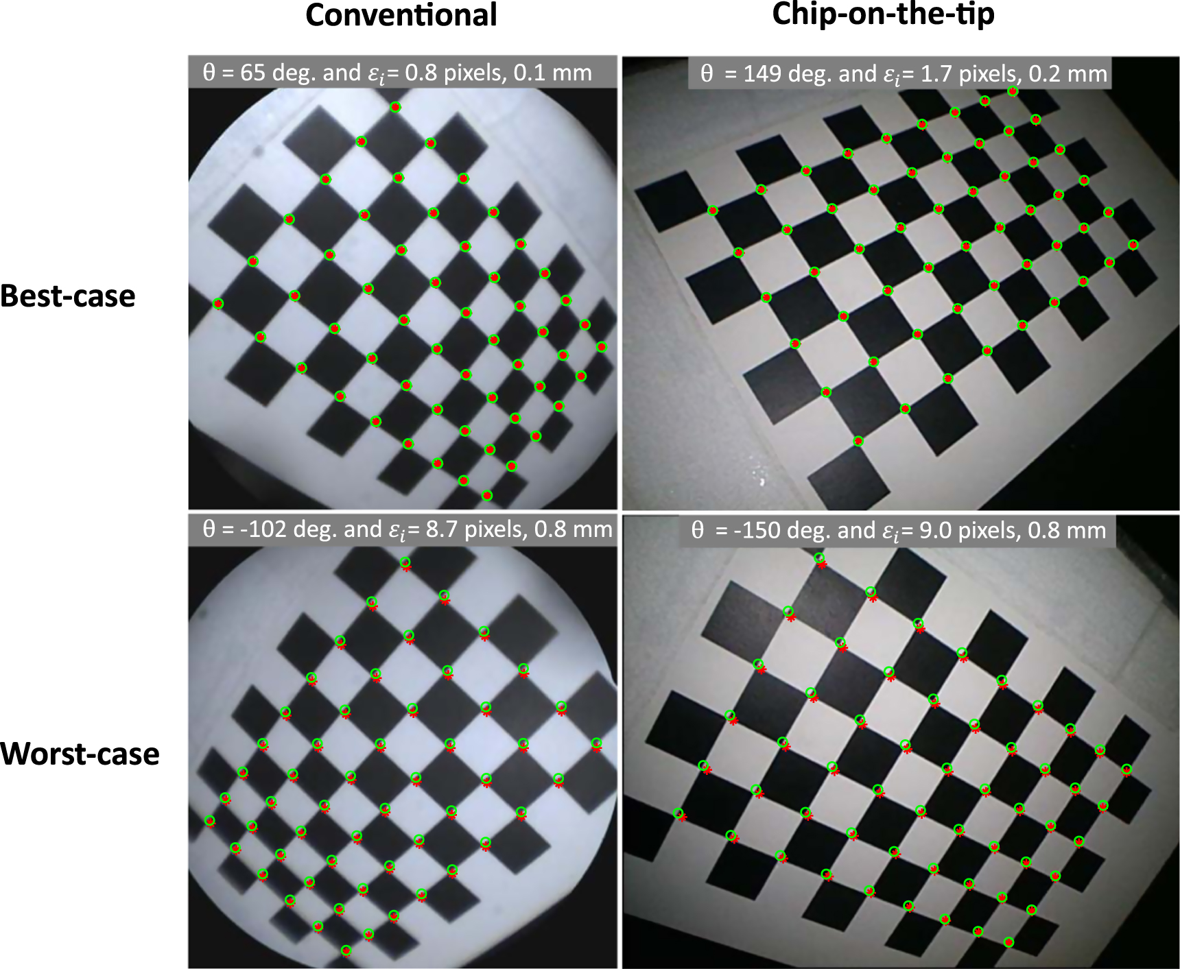 An improved camera model for oblique-viewing laparoscopes: high ...