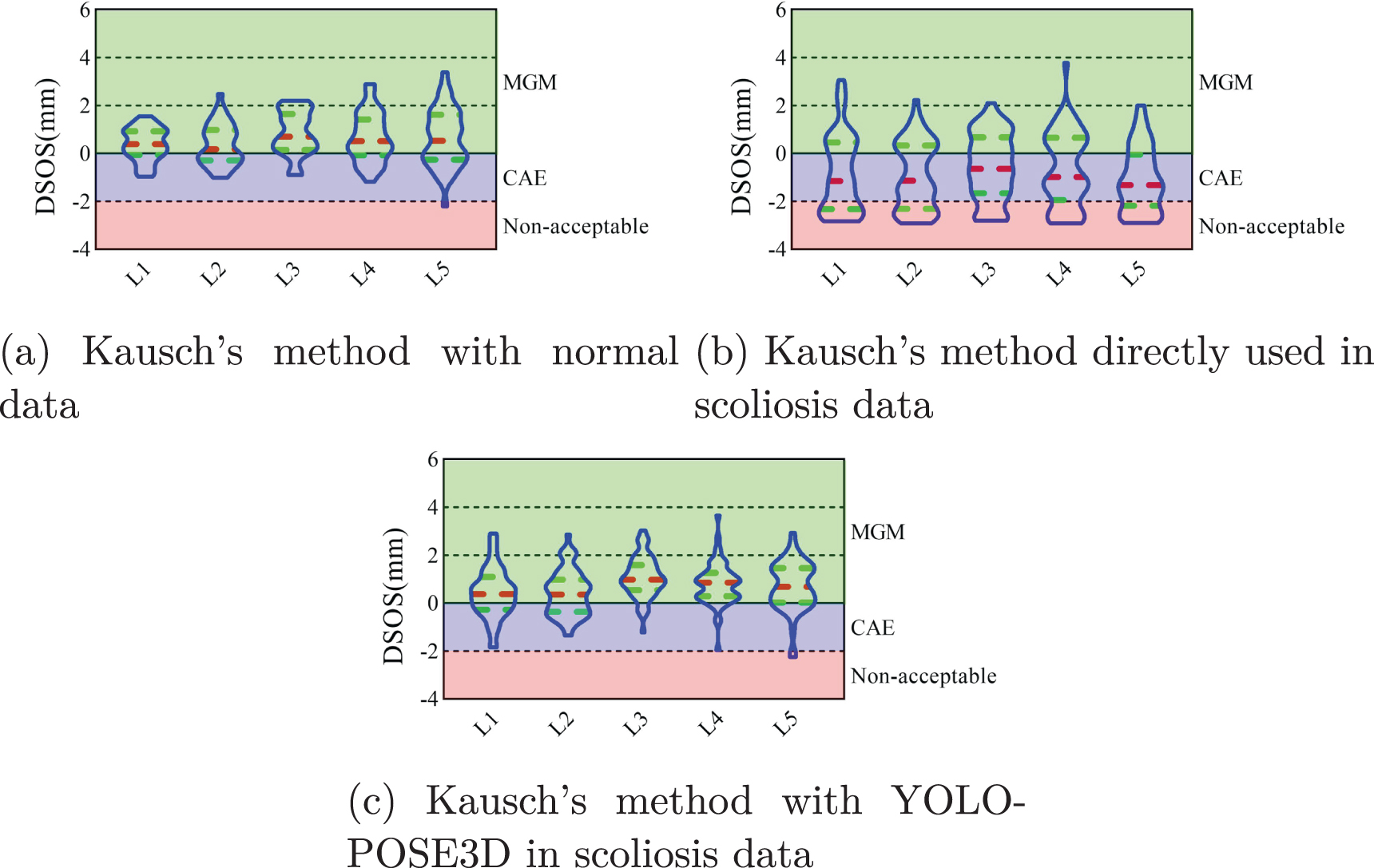 Improving pedicle screw path planning by vertebral posture estimation ...