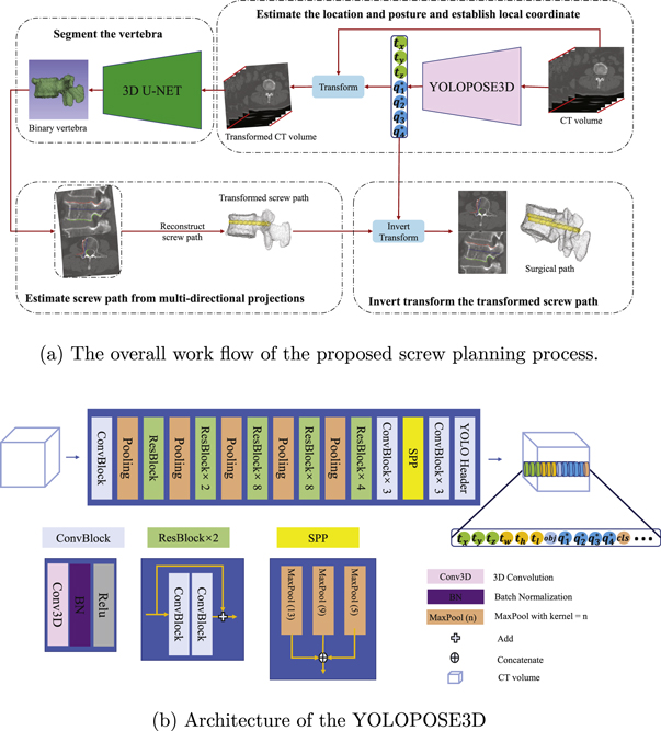 Improving pedicle screw path planning by vertebral posture estimation ...