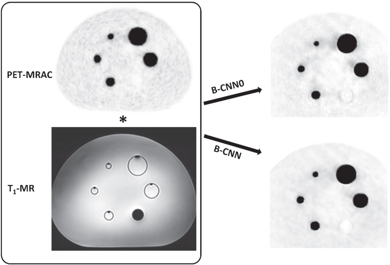 Evaluation of MR anatomically-guided PET reconstruction using a convolutional neural network in ...