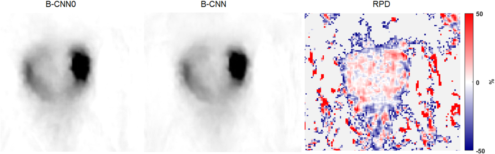 Evaluation of MR anatomically-guided PET reconstruction using a convolutional neural network in ...