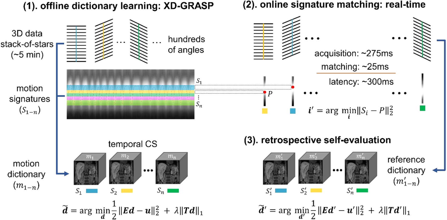 Real-time 4D MRI using MR signature matching (MRSIGMA) on a 1.5T MR-Linac system - IOPscience