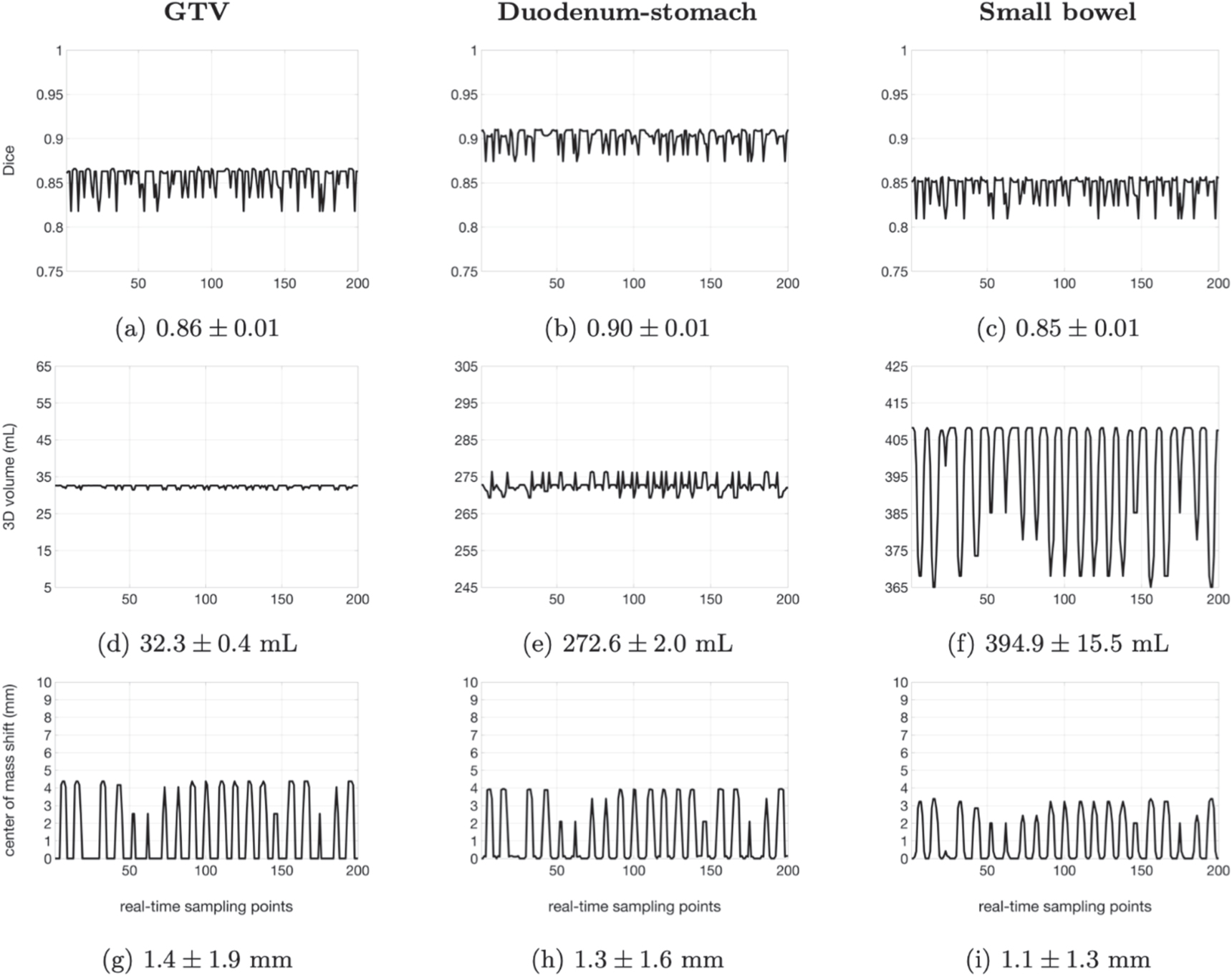 Real-time 4D MRI using MR signature matching (MRSIGMA) on a 1.5T MR-Linac system - IOPscience