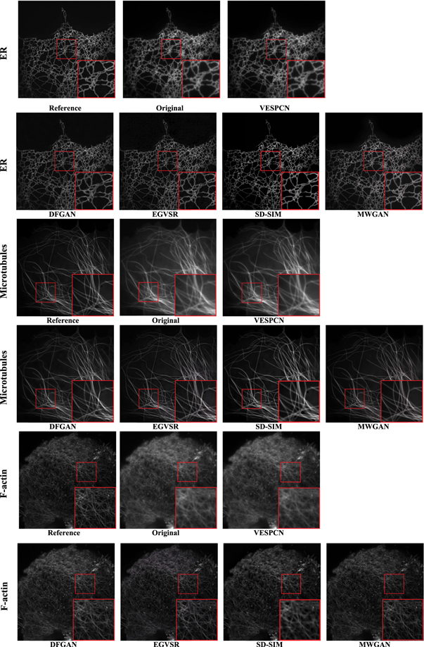 A novel multi-frame wavelet generative adversarial network for ...