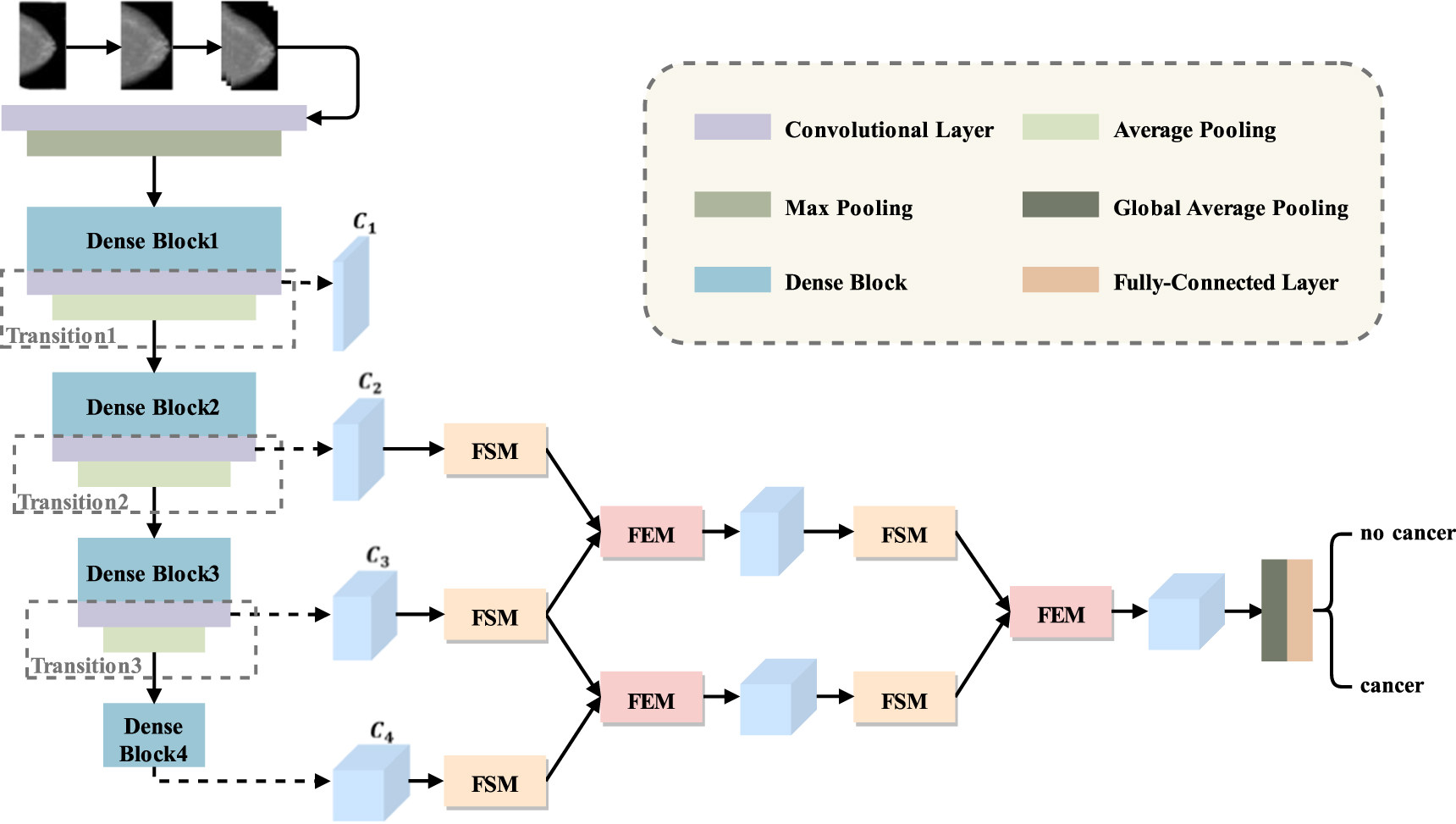 FSE-Net: feature selection and enhancement network for mammogram classification - IOPscience