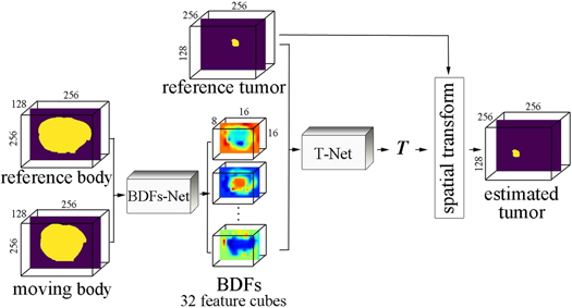 Extracting lung contour deformation features with deep learning for internal target motion ...