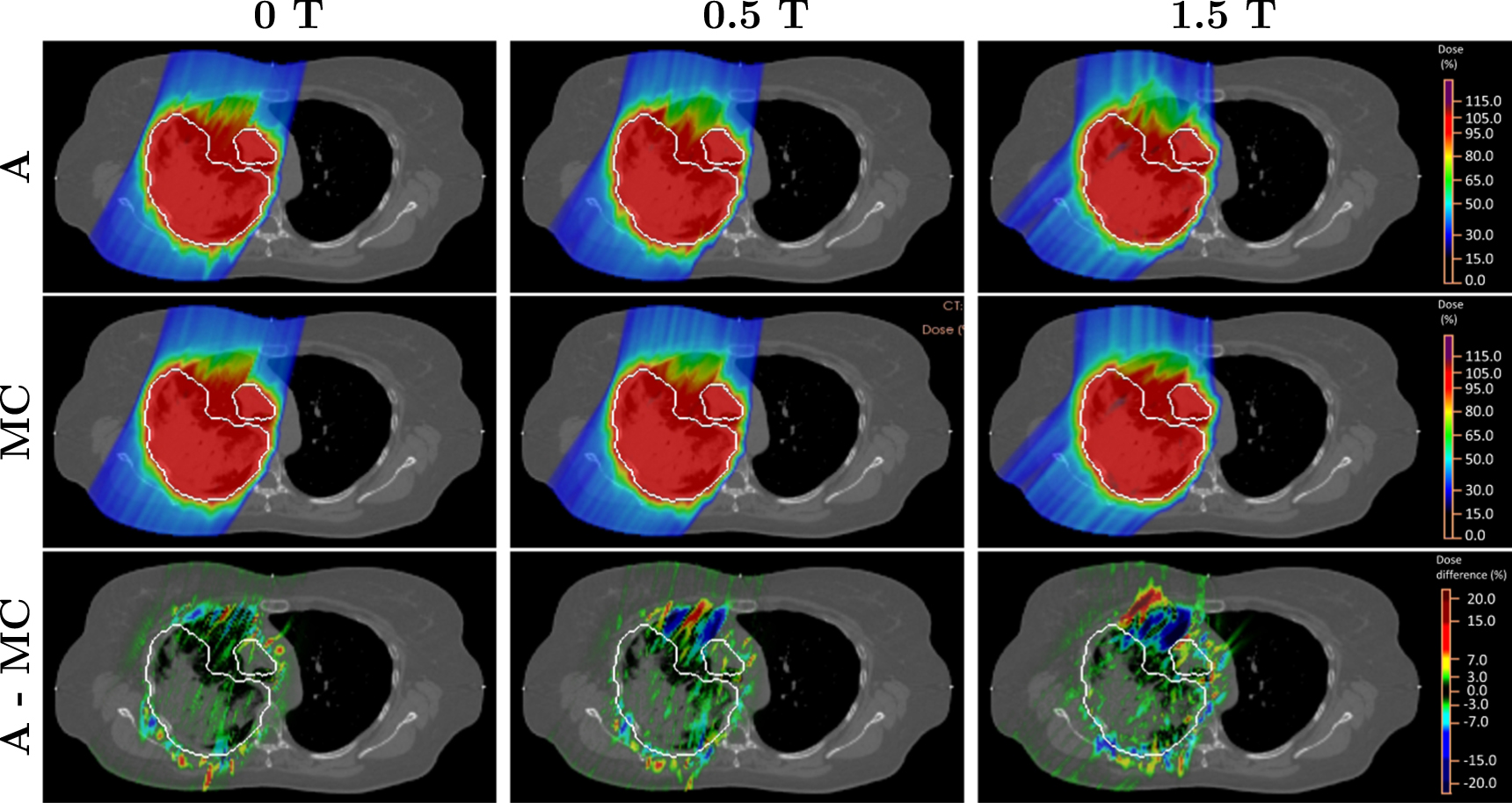 A fast analytical dose calculation approach for MRI-guided proton ...