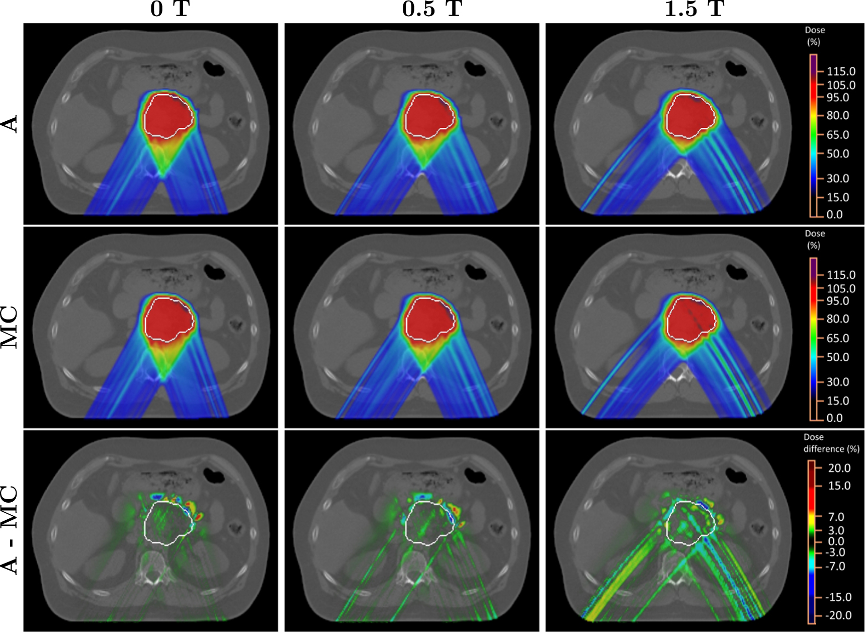 A fast analytical dose calculation approach for MRI-guided proton ...