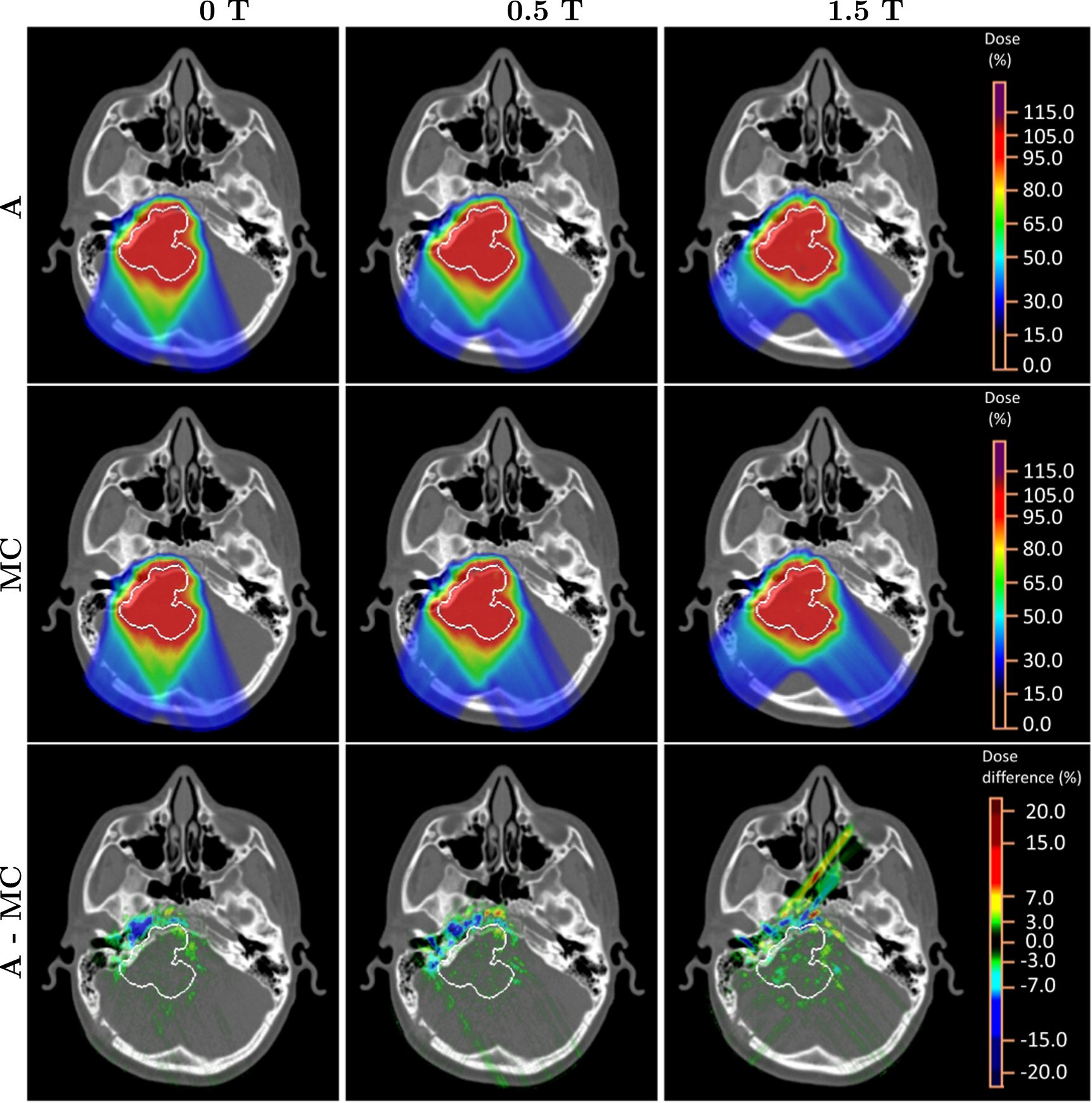A fast analytical dose calculation approach for MRI-guided proton ...