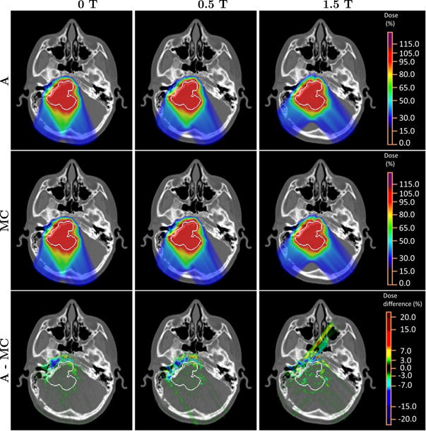 A fast analytical dose calculation approach for MRI-guided proton ...