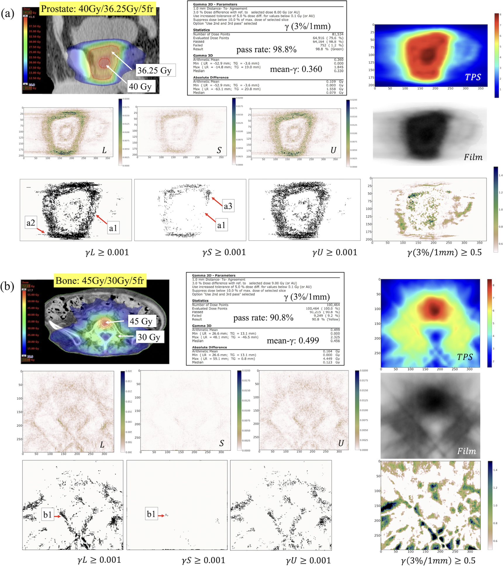 Extracting the gradient component of the gamma index using the Lie ...