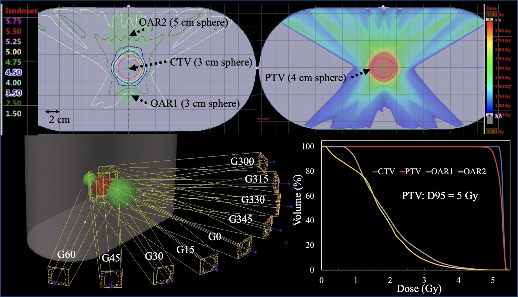 Extracting the gradient component of the gamma index using the Lie ...