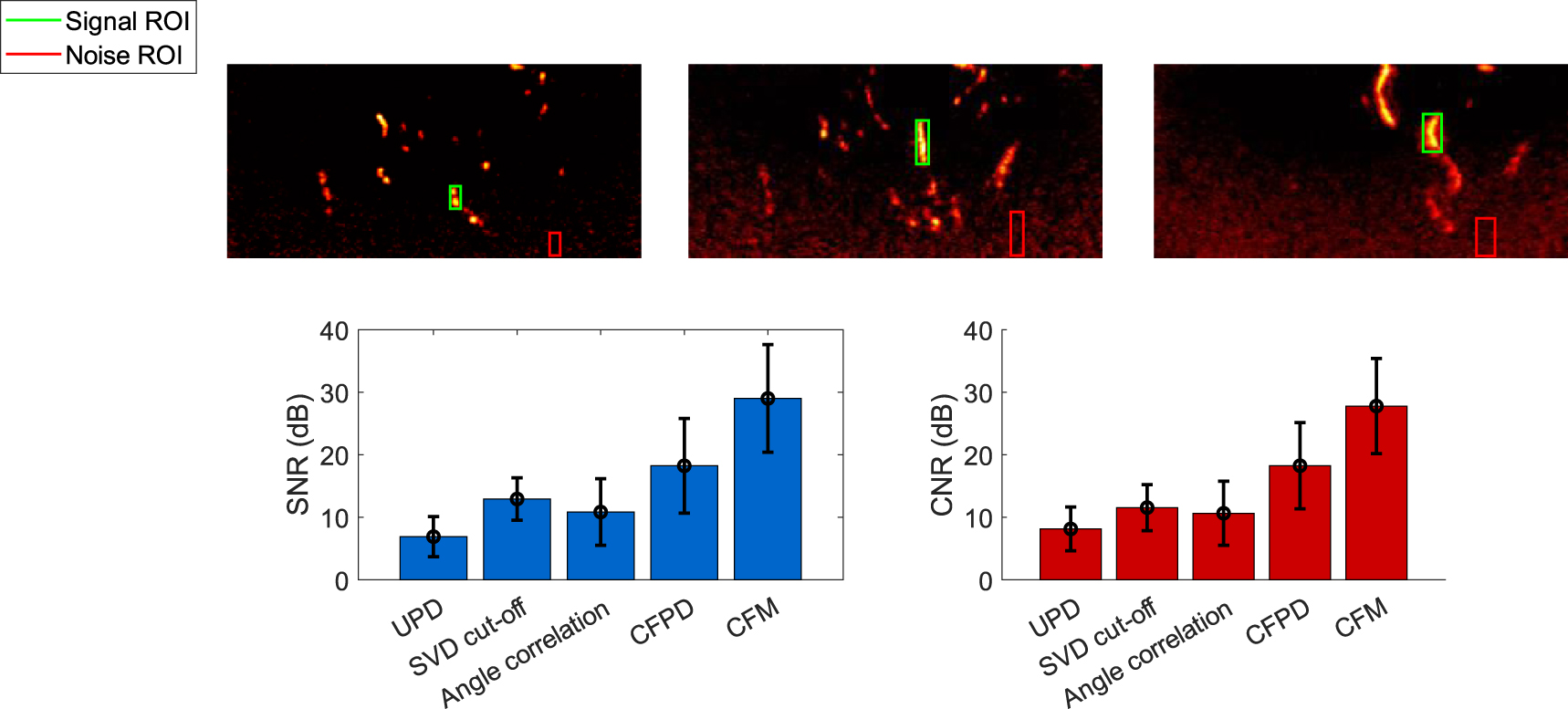 Adaptive noise reduction for power Doppler imaging using SVD filtering ...