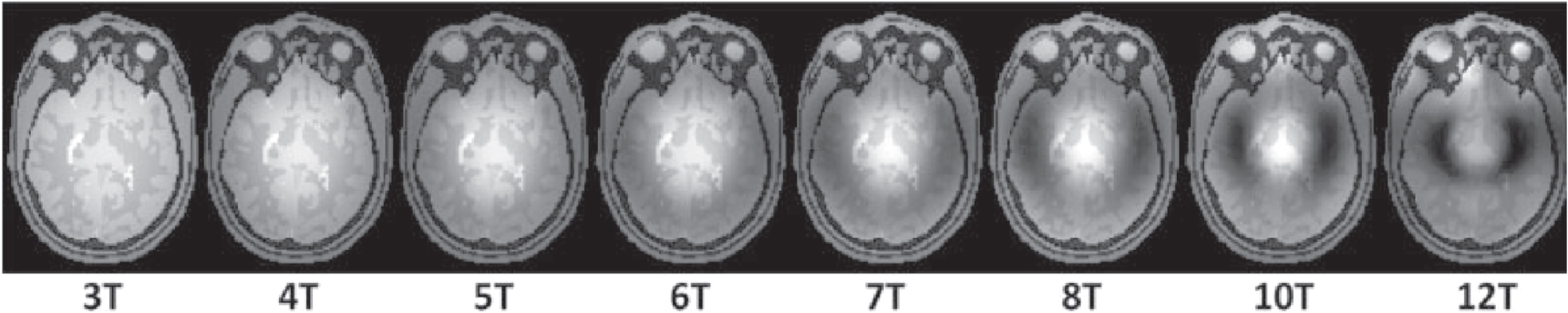 Ultra-high field MRI: parallel-transmit arrays and RF pulse design - IOPscience
