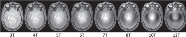 Ultra-high field MRI: parallel-transmit arrays and RF pulse design ...