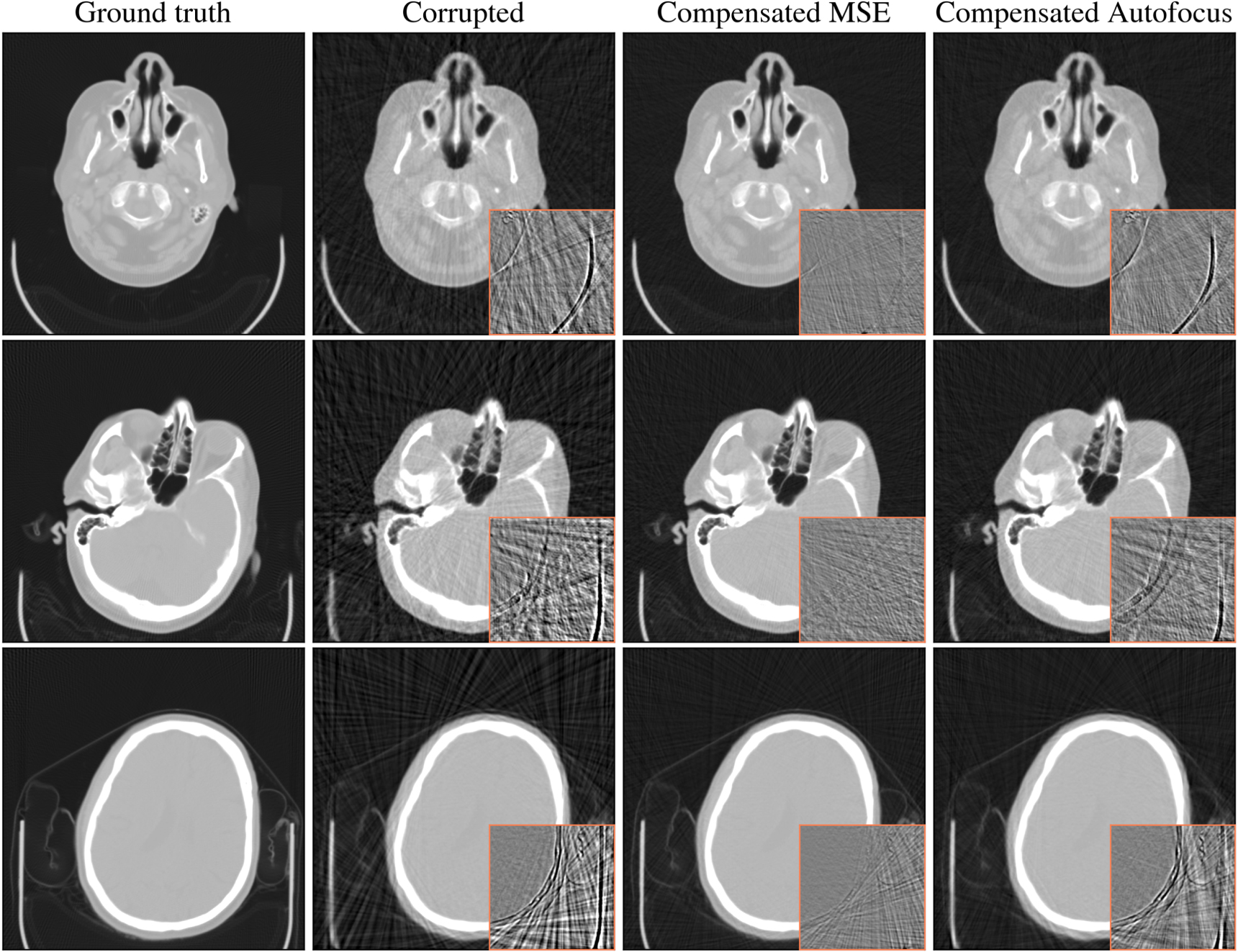 Gradient-based geometry learning for fan-beam CT reconstruction ...