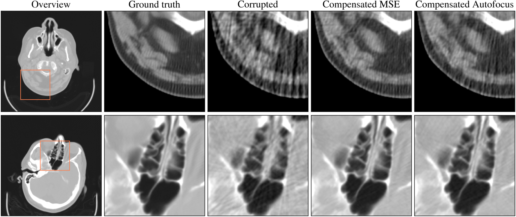 Gradient-based geometry learning for fan-beam CT reconstruction ...