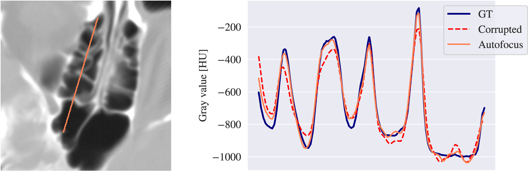 Gradient-based geometry learning for fan-beam CT reconstruction ...