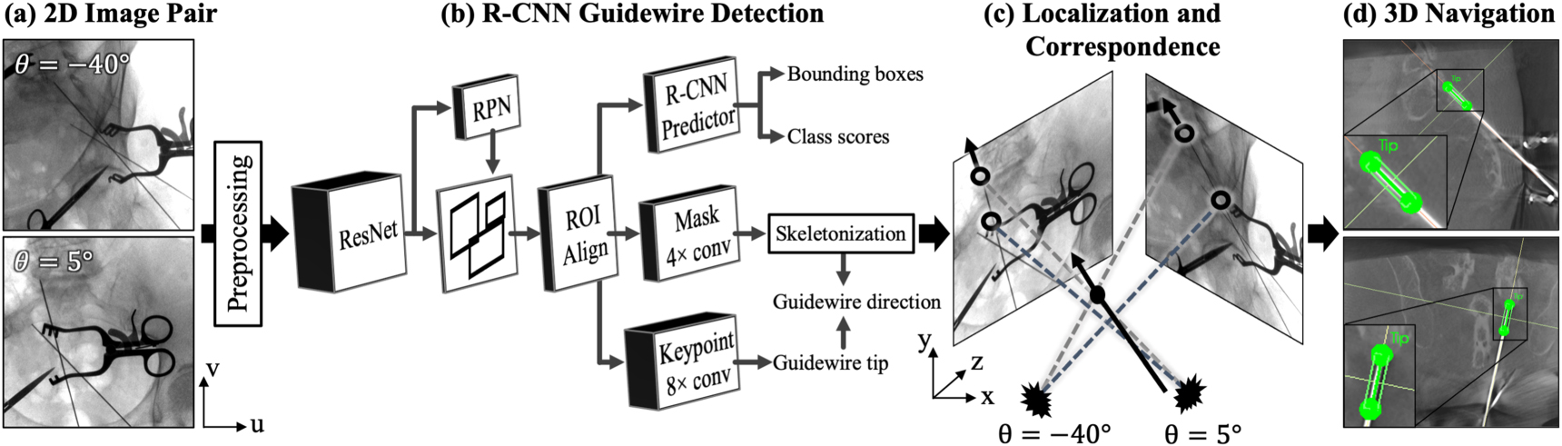 Surgical navigation for guidewire placement from intraoperative ...