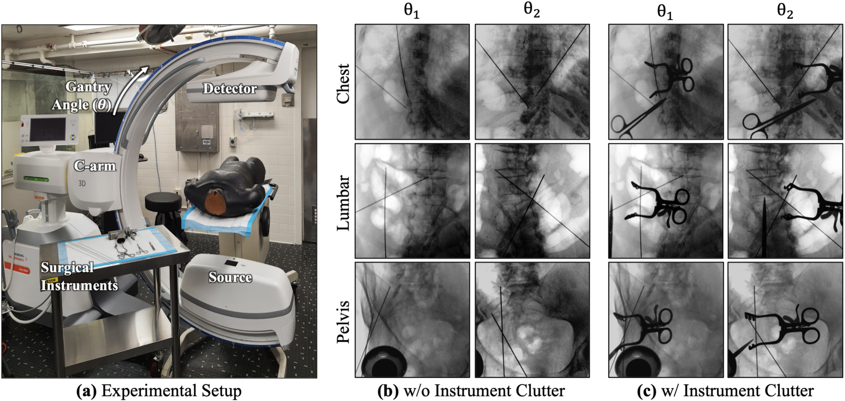 Surgical navigation for guidewire placement from intraoperative ...