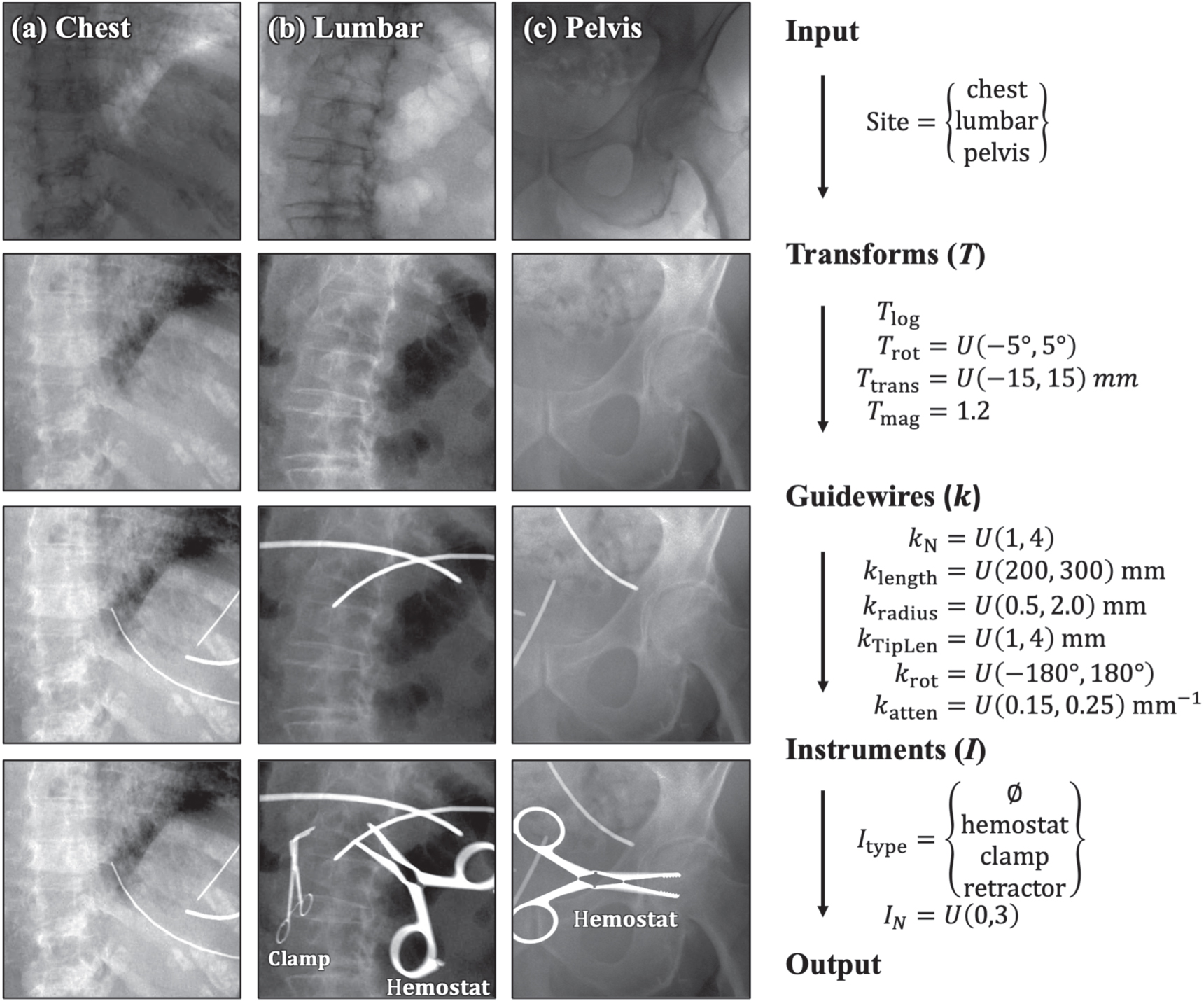 Surgical navigation for guidewire placement from intraoperative ...