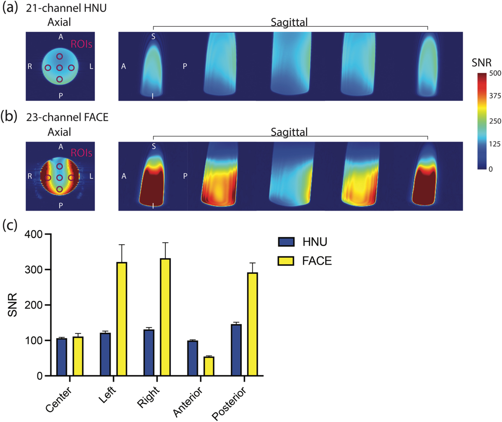 Flexible array coil for cervical and extraspinal (FACE) MRI at 3.0 ...