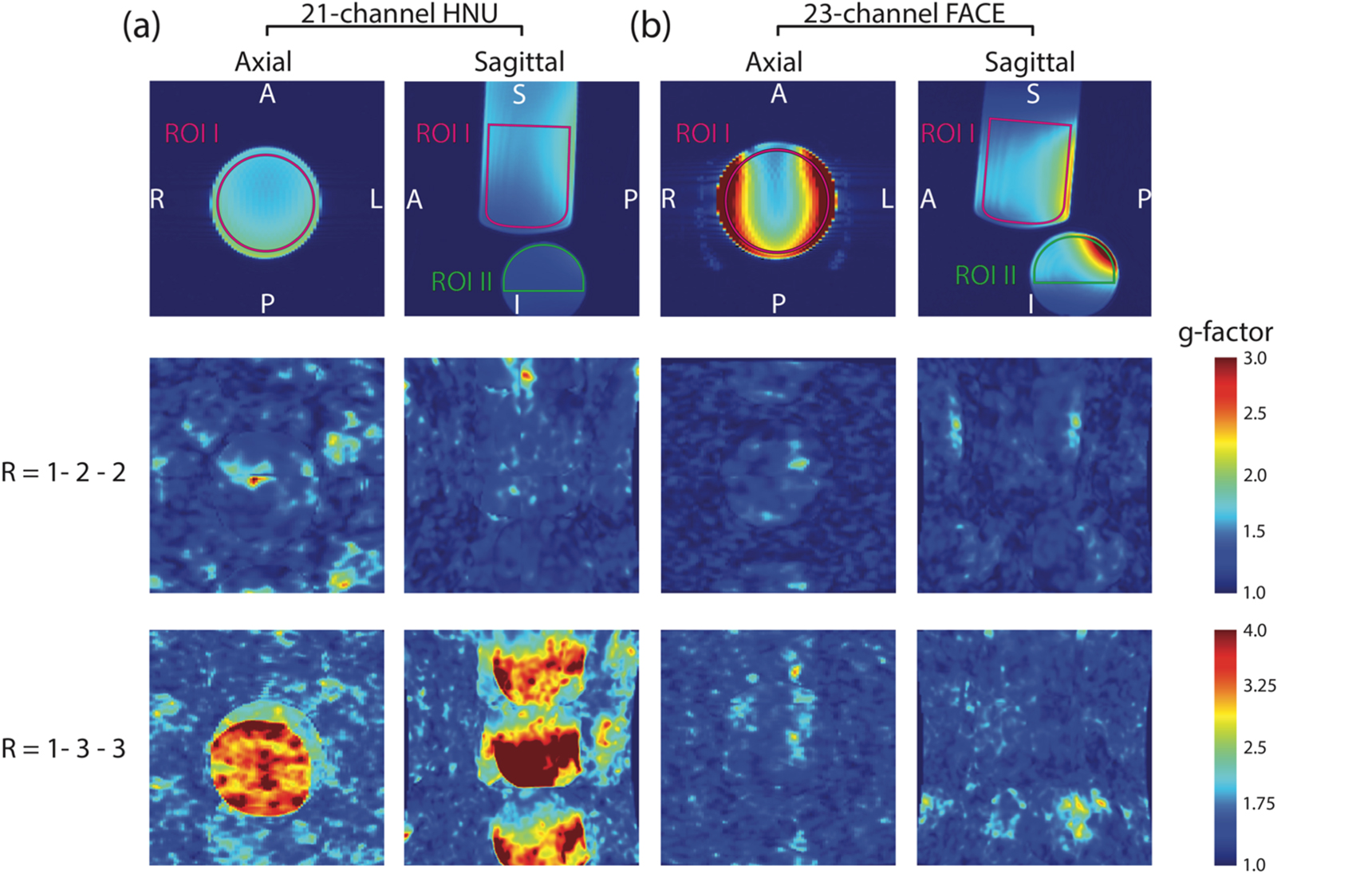 Flexible array coil for cervical and extraspinal (FACE) MRI at 3.0 ...