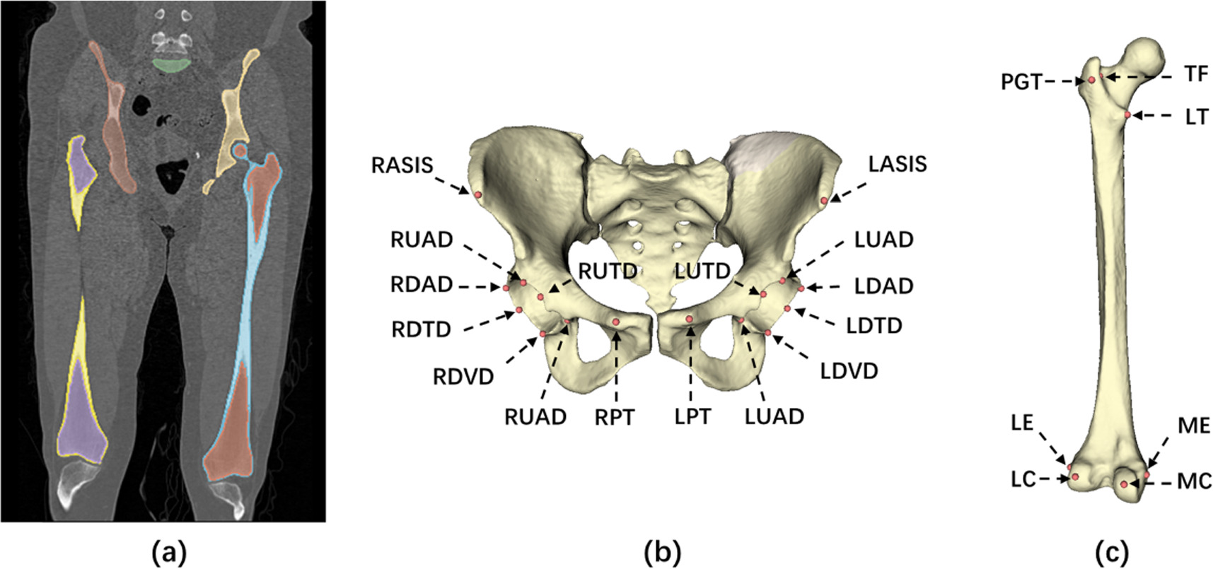 Deep learning-based workflow for hip joint morphometric parameter ...
