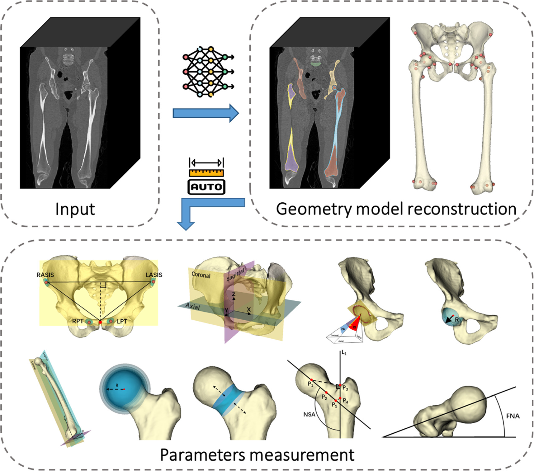 Deep learning-based workflow for hip joint morphometric parameter ...