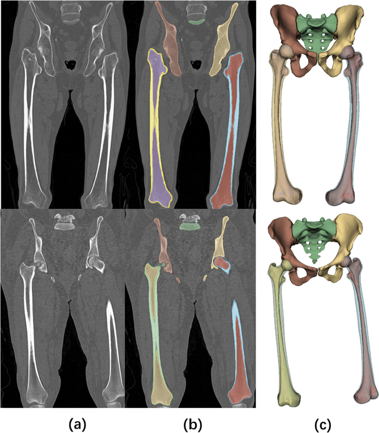 Deep learning-based workflow for hip joint morphometric parameter ...