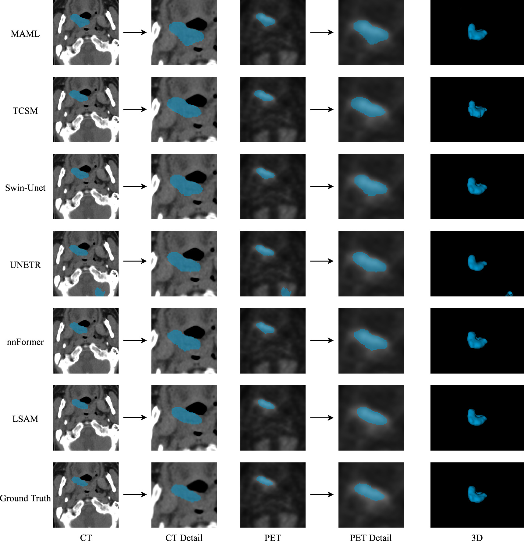 LSAM: L2-norm self-attention and latent space feature interaction for ...