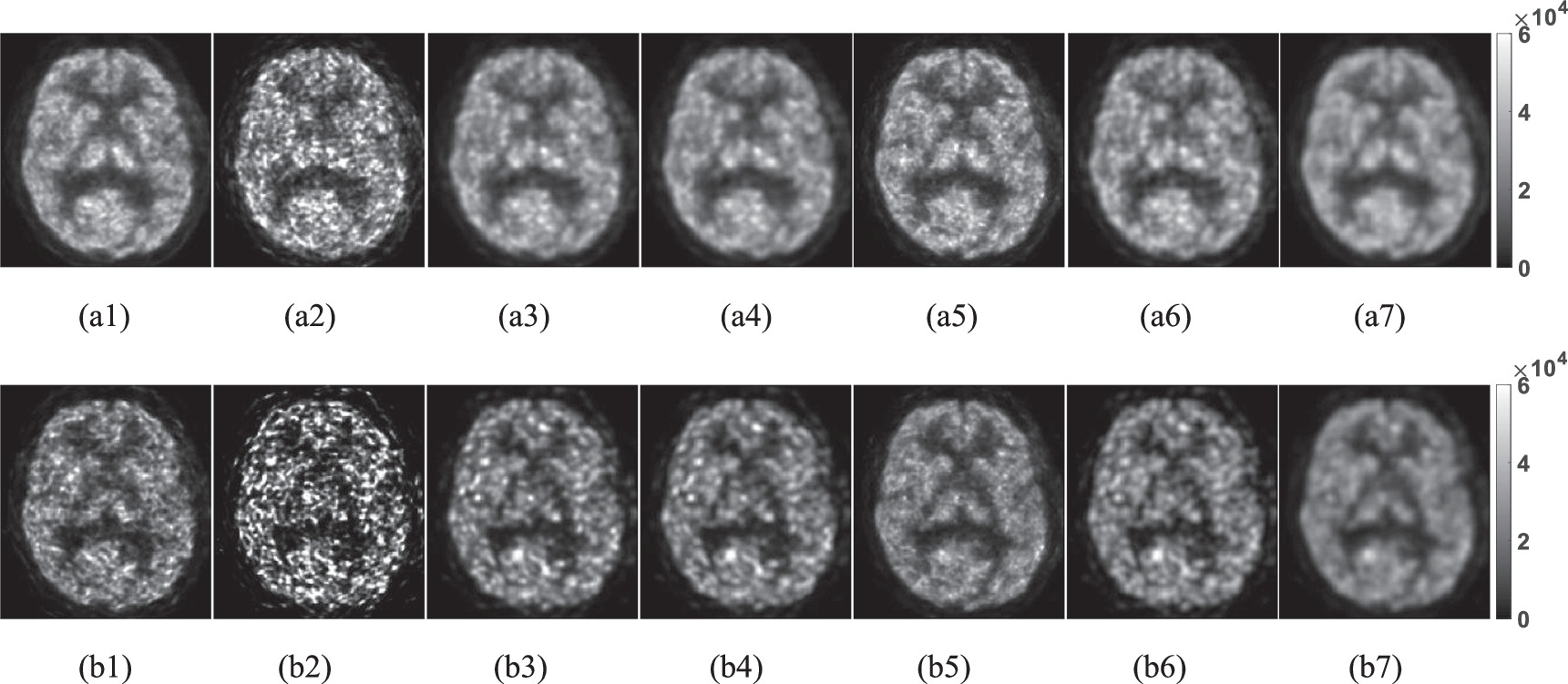 Dose reduction in dynamic synaptic vesicle glycoprotein 2A PET imaging ...