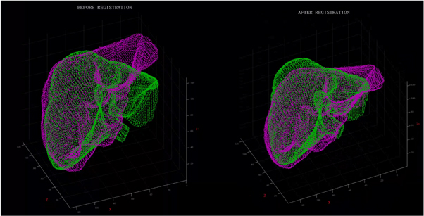 Volumetric feature points integration with bio-structure-informed guidance for deformable multi ...