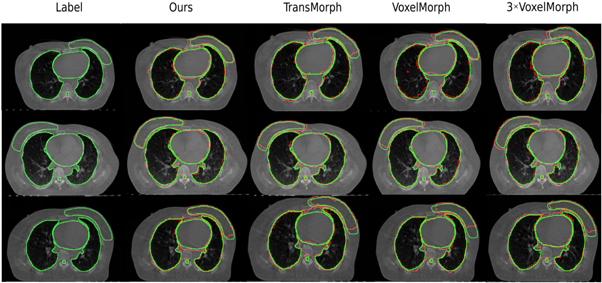 Volumetric feature points integration with bio-structure-informed guidance for deformable multi ...