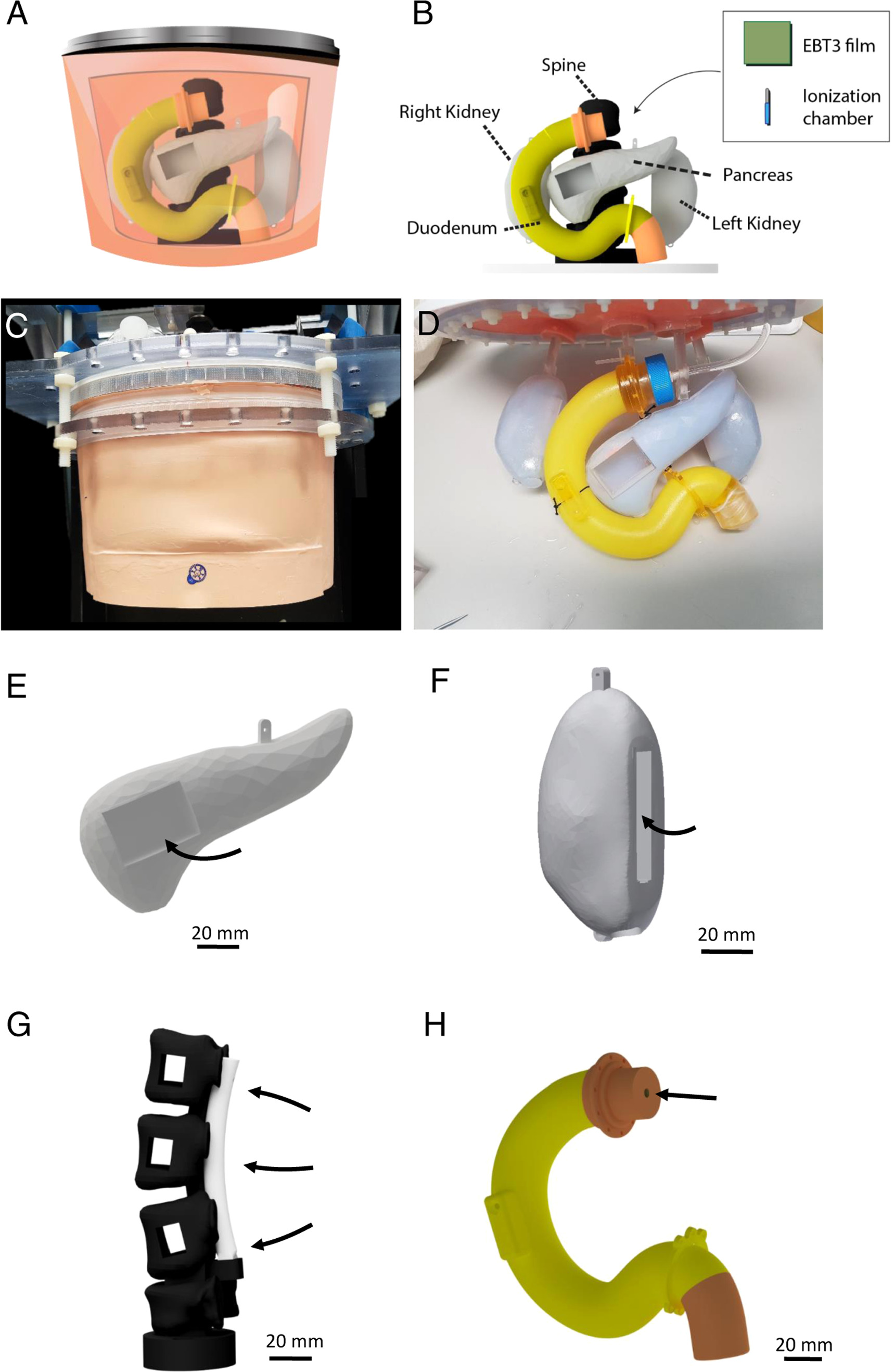 A phantom to simulate organ motion and its effect on dose distribution ...