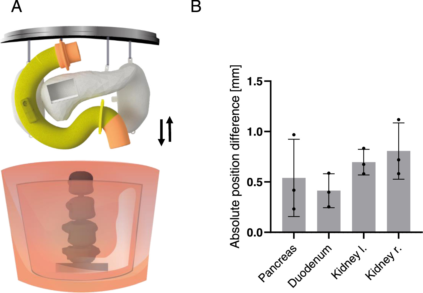 A phantom to simulate organ motion and its effect on dose distribution ...