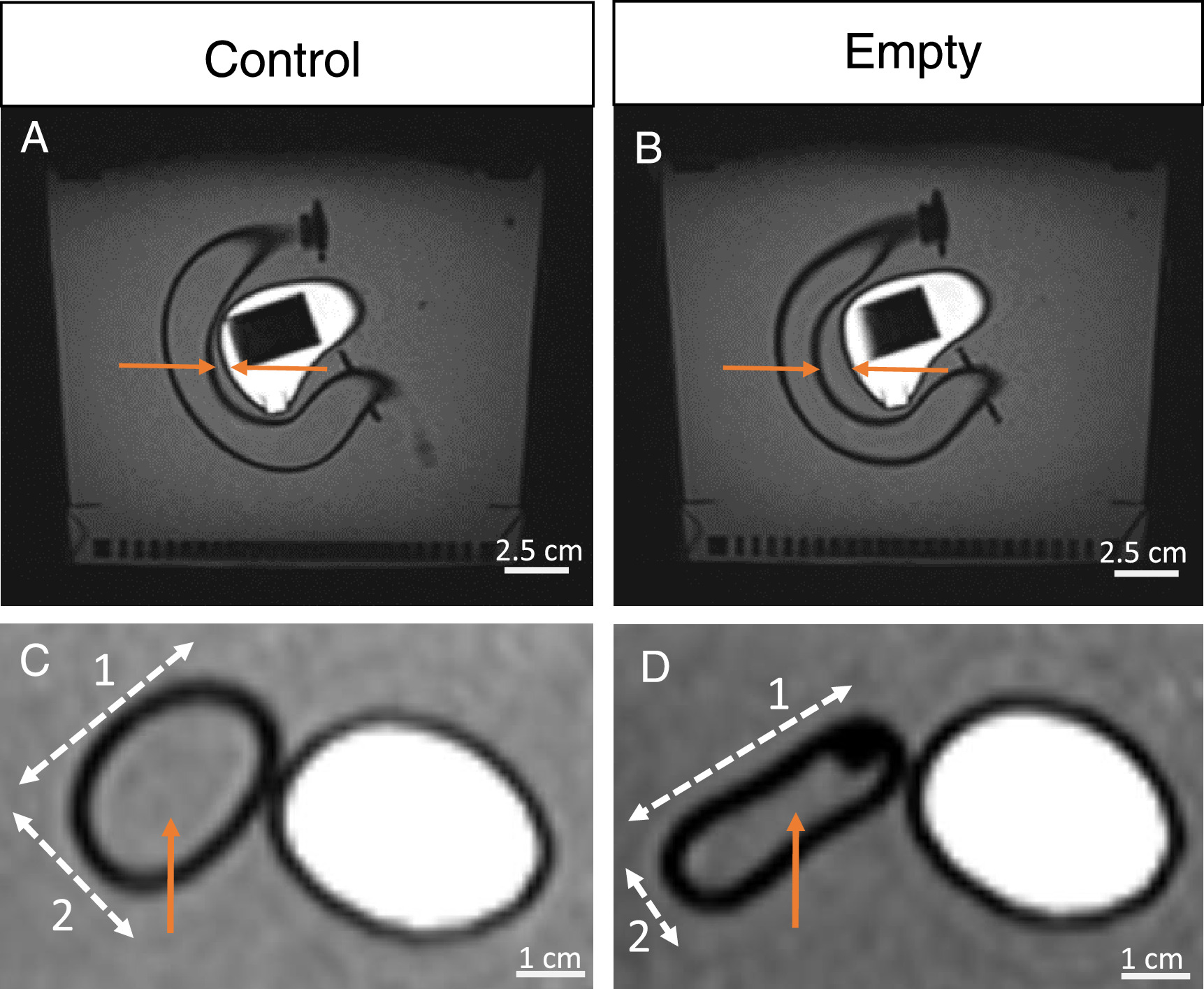A phantom to simulate organ motion and its effect on dose distribution ...