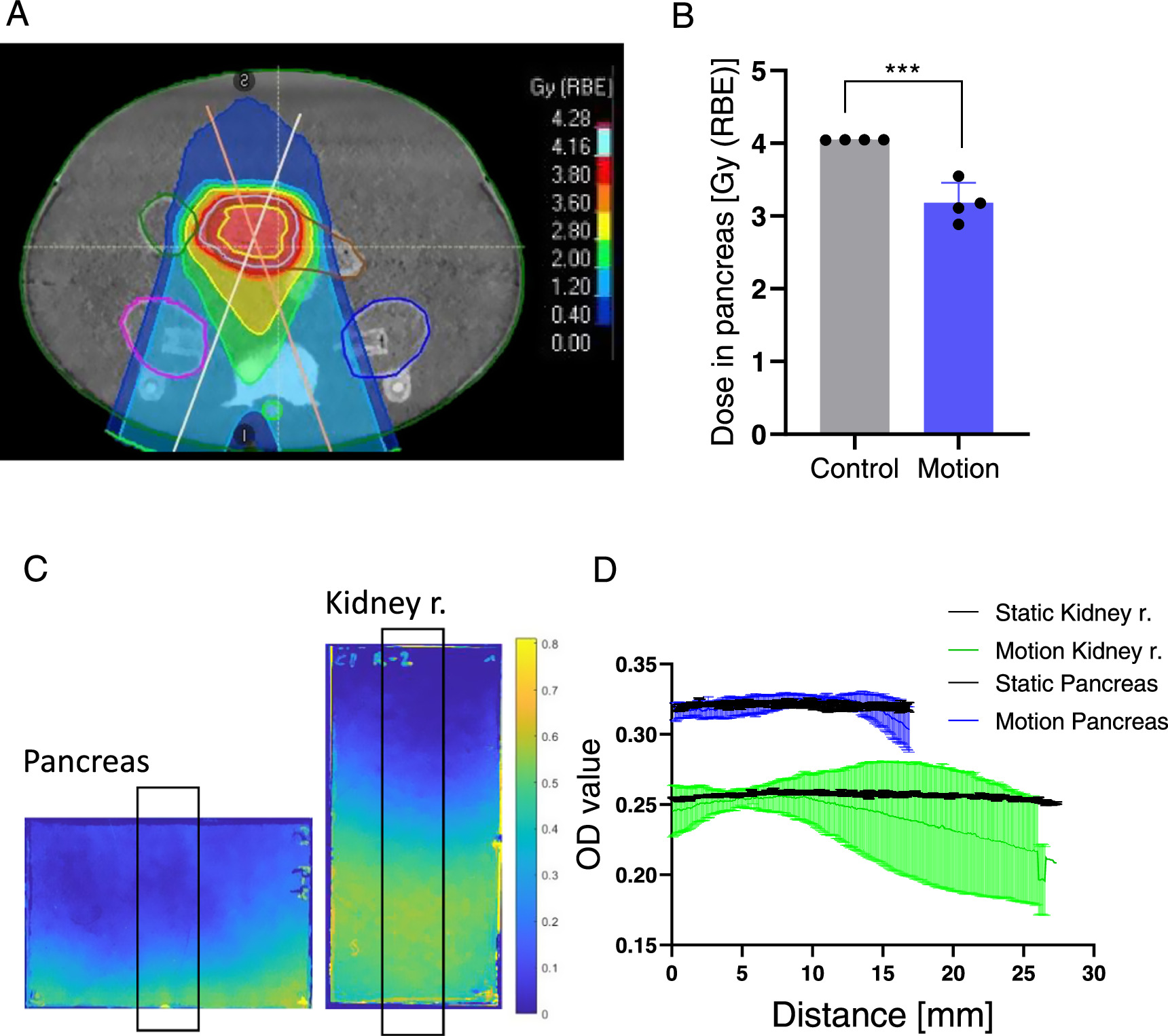 A phantom to simulate organ motion and its effect on dose distribution ...