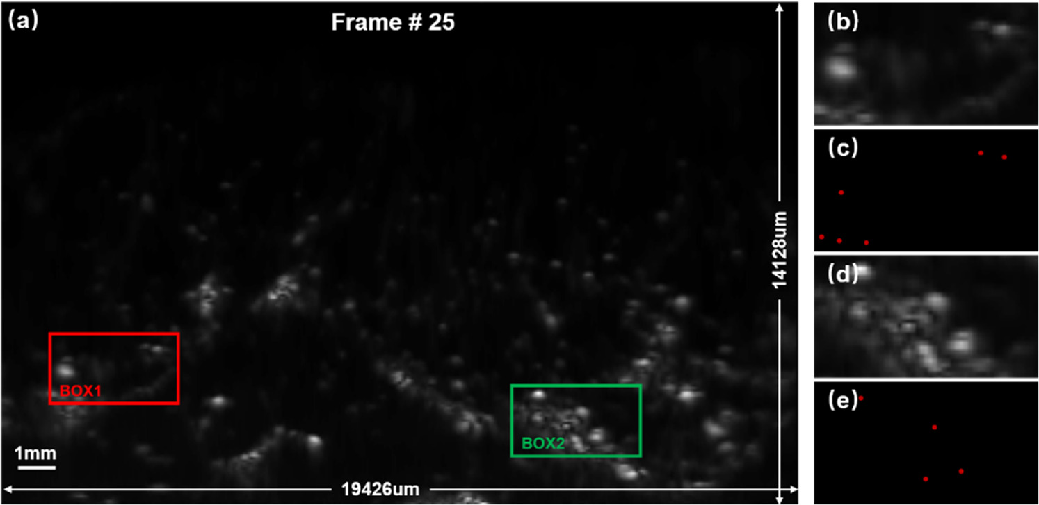 Deep learning for fast super-resolution ultrasound microvessel imaging ...